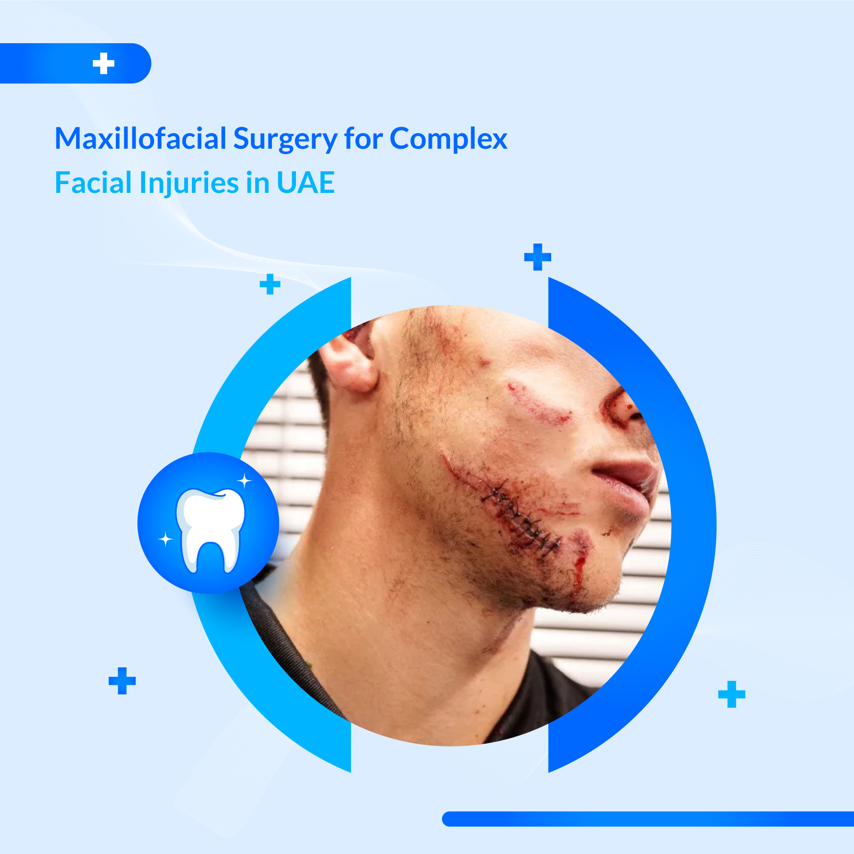 Facial Injury Specialist UAE | Facial Trauma Reconstruction