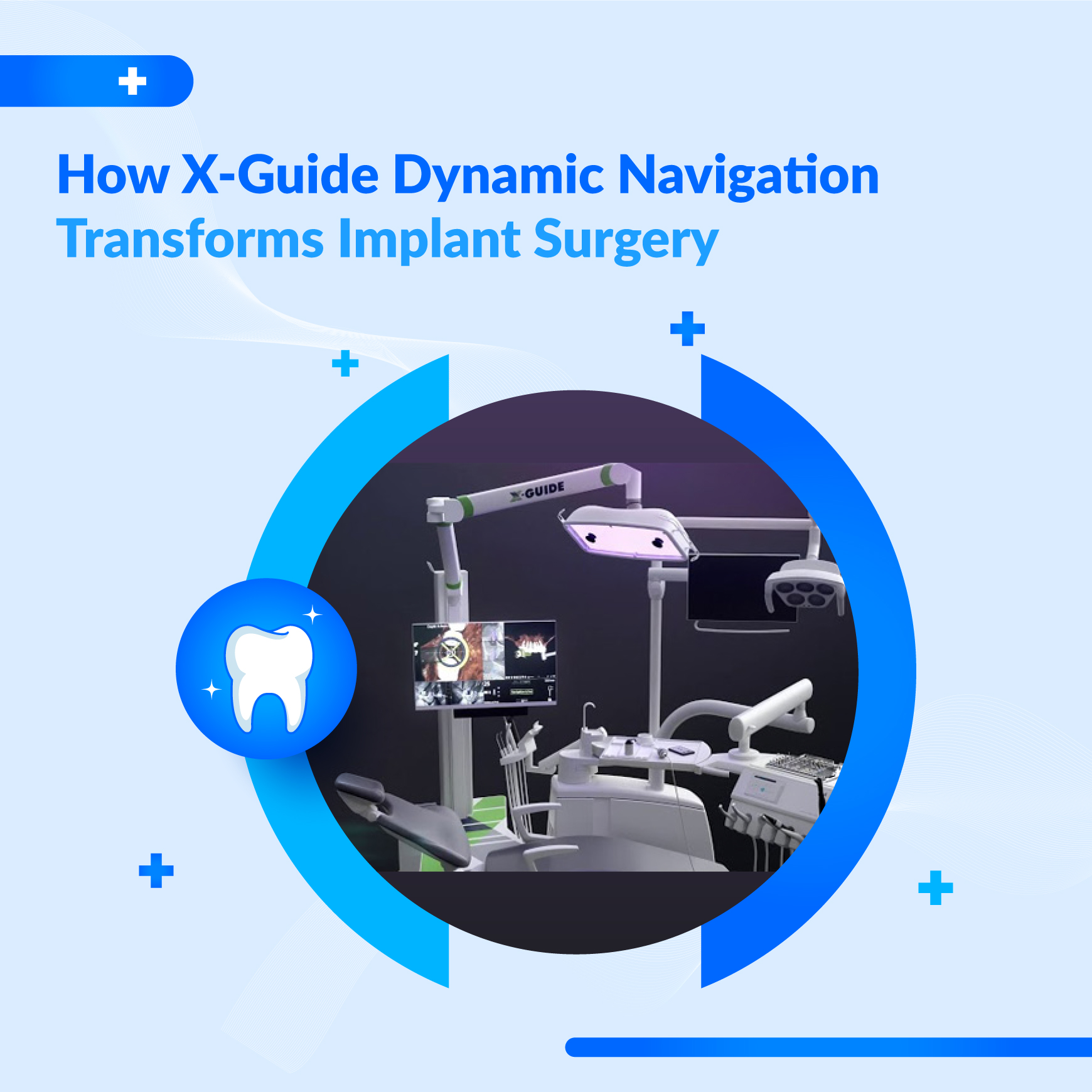 Navigation-Guided Dental Implants | X-NavTech Dubai